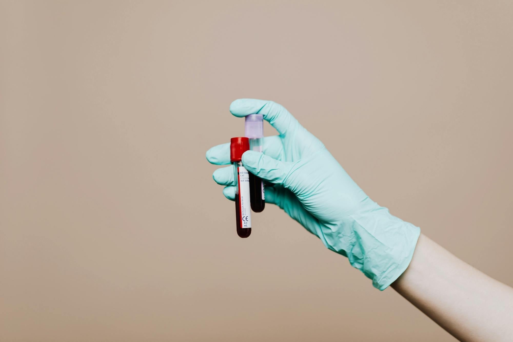 The Science Behind Xcellara™: Harnessing the Power of Cellular Regener